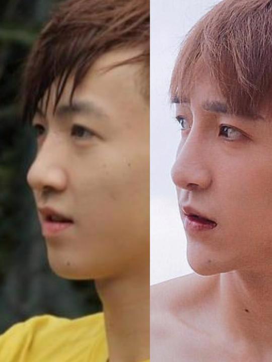 [圖]天地有正氣 Anson Lo無整容 - 香港高登討論區